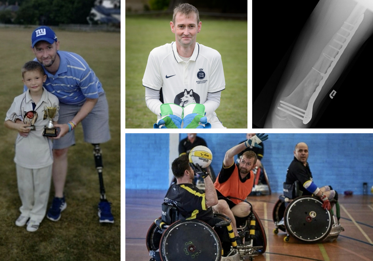 Club cricketer back at the crease 10 weeks after leg amputation